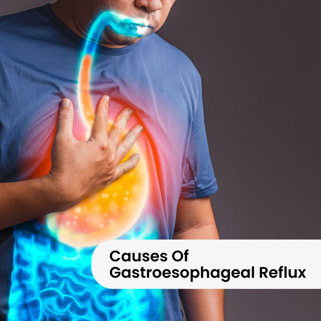 Causes Of Gastroesophageal Reflux – IMMUNOSCIENCES